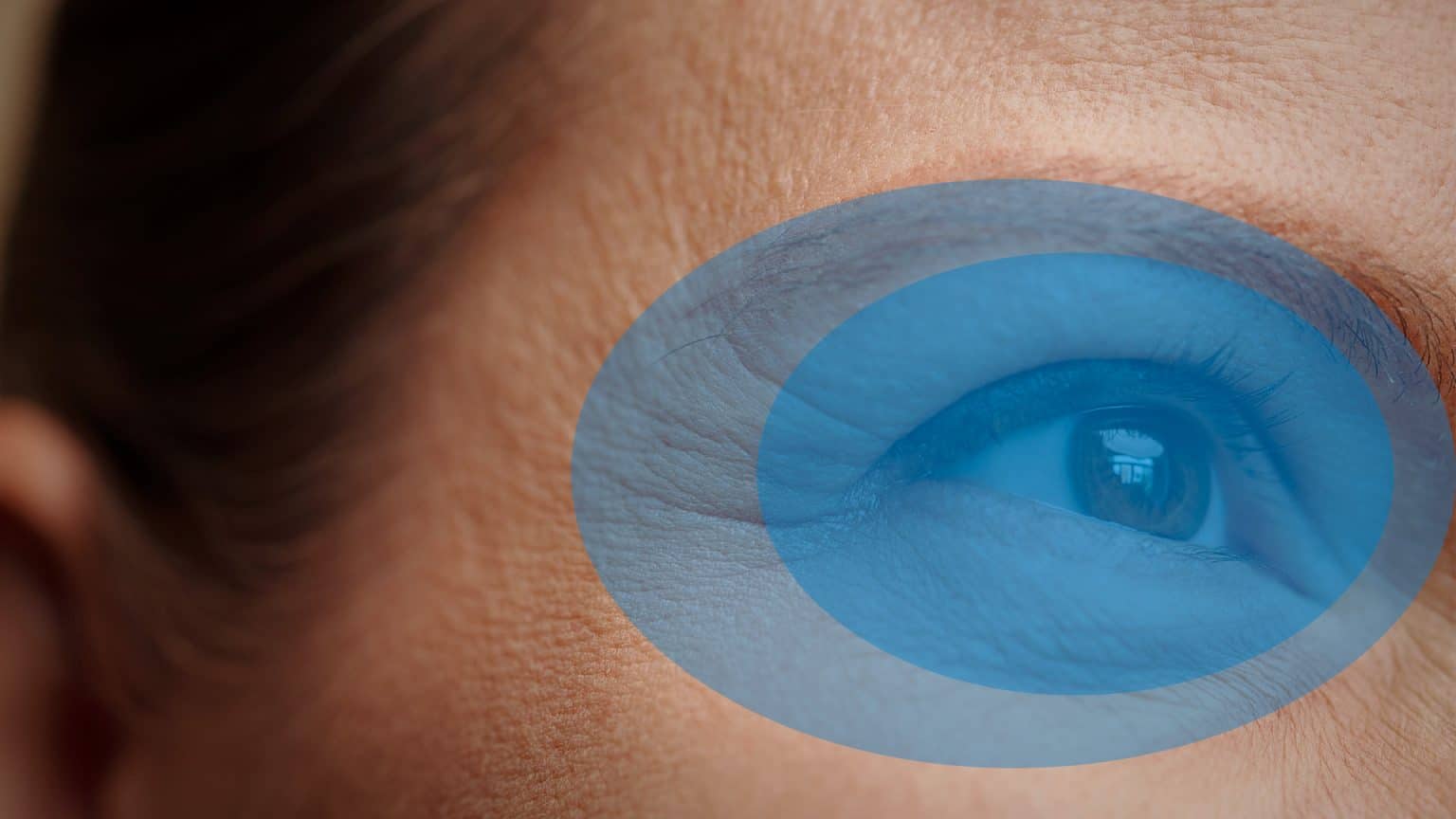 Orbital diseases (eye socket diseases) - Faces Facial Surgery in Lisboa ...